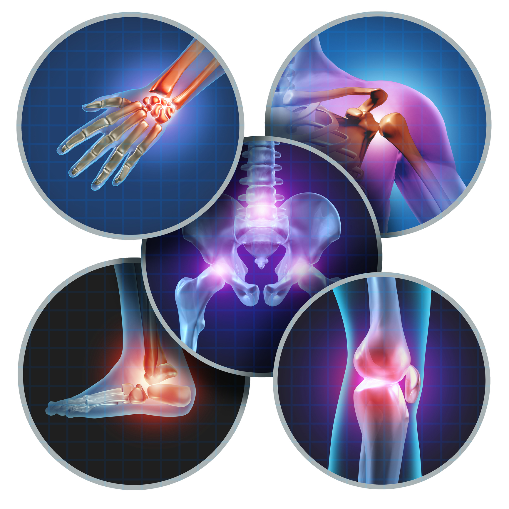 10 Tips to Improve Bone Health | North Country Orthopaedic Group | NY